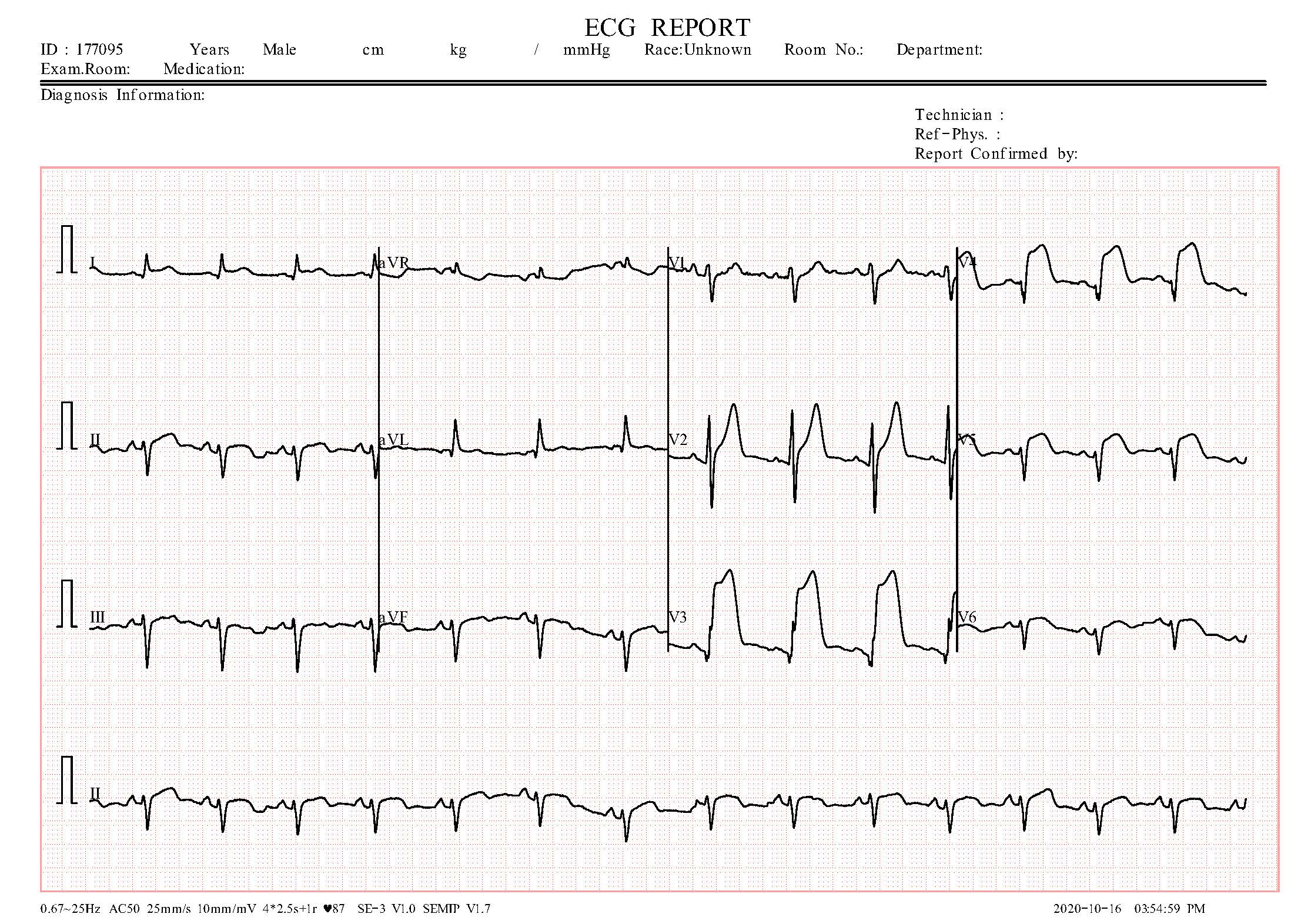 AI-EKG Classification Dataset by AIR