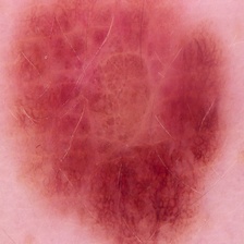 Skin Disease Detection system Instance Segmentation Dataset and Pre-Trained Model by Wildlife ...