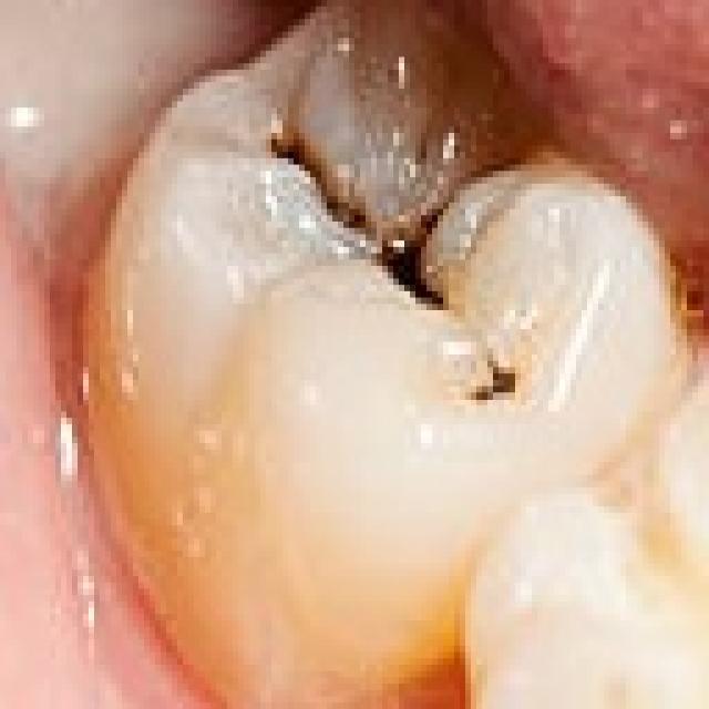 Dental Dataset Dental Dataset 6wcff Roboflow Universe