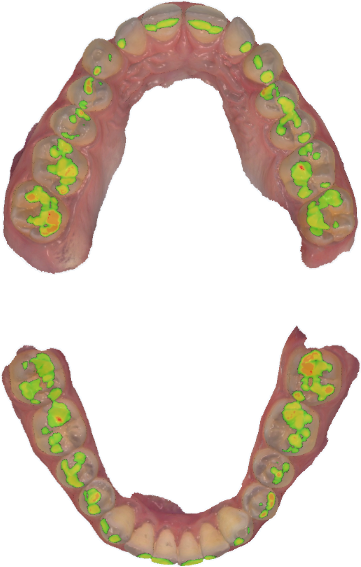 Learning (learning-5p9bd) - Roboflow Universe