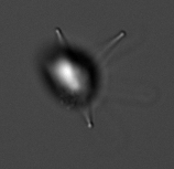 tip-finding-individualZ Object Detection Dataset by suctorianyolotraining