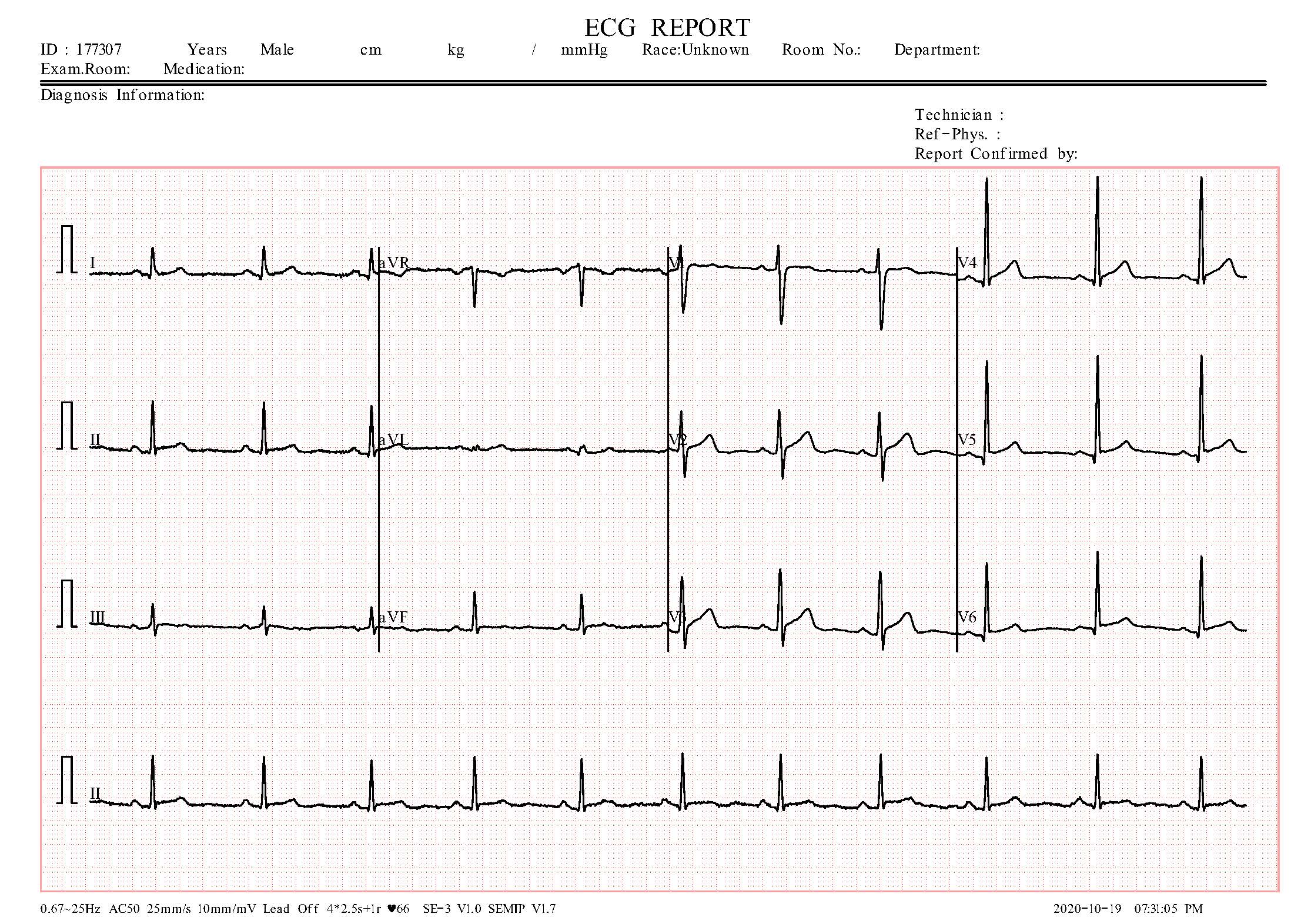 ecg normal Object Detection Dataset by pyh