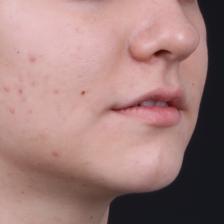 Zigoma görünümü Classification Dataset by Tez