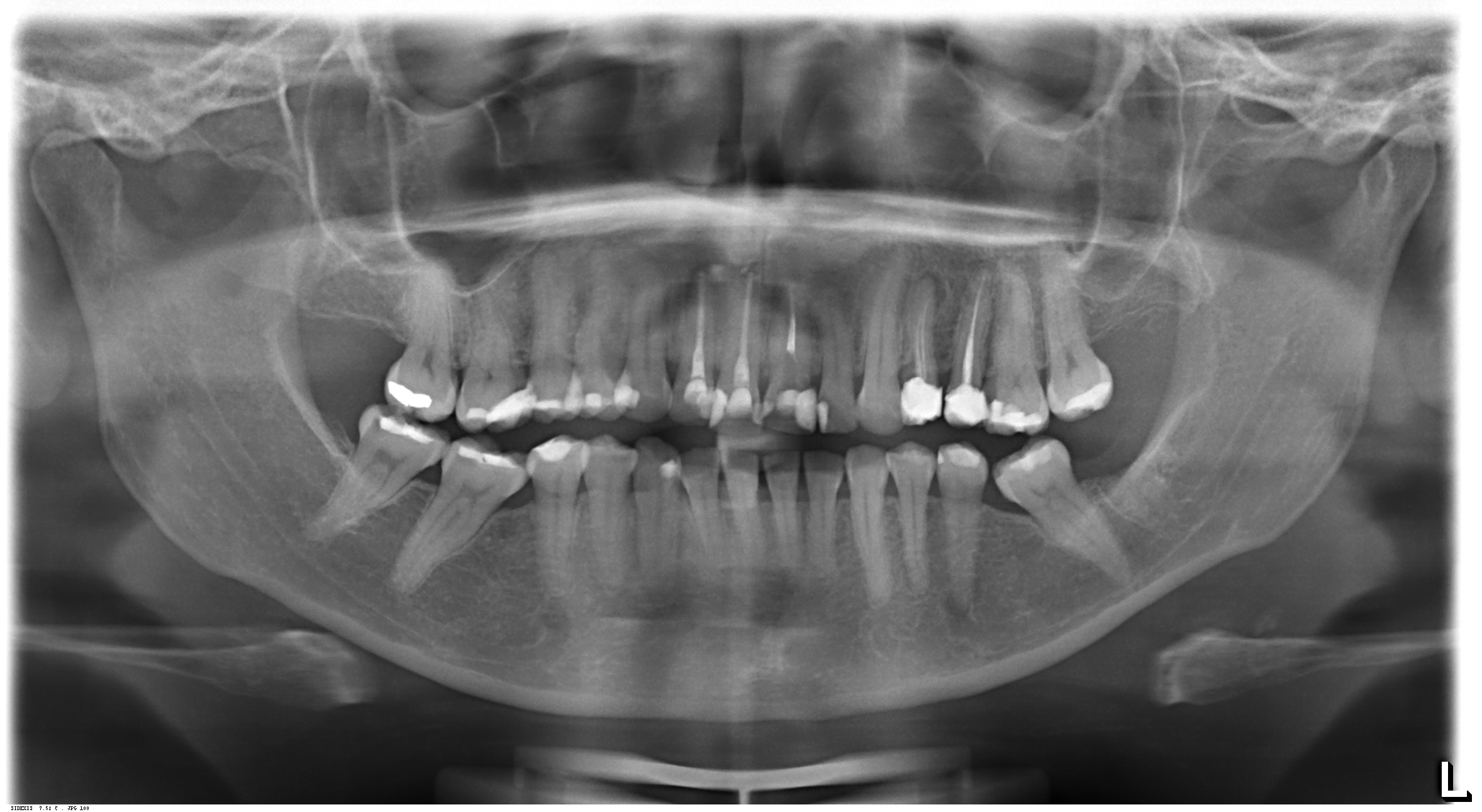Odontoai Instance Segmentation Dataset by Evident