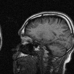 mri Classification Model by test