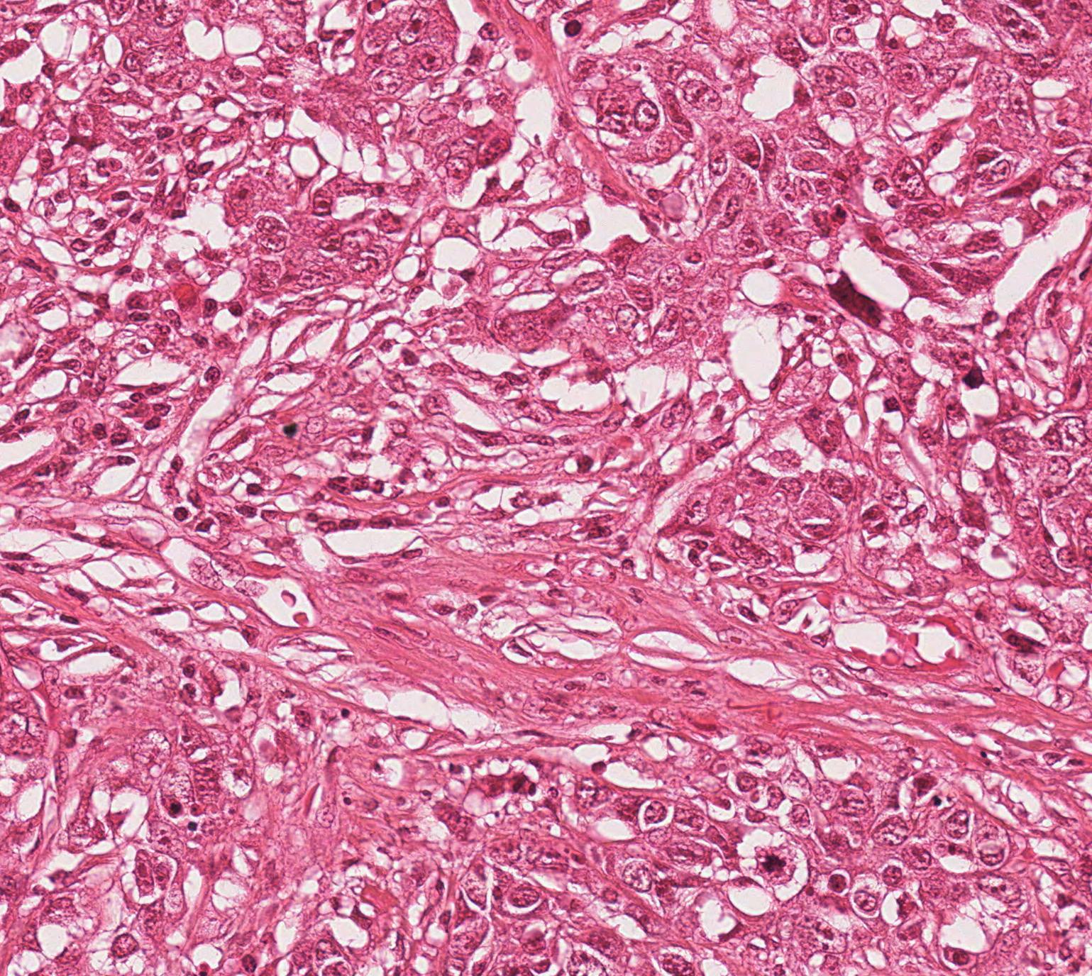 Ms Mitosis Detection Object Detection Dataset By Mitosisdetection