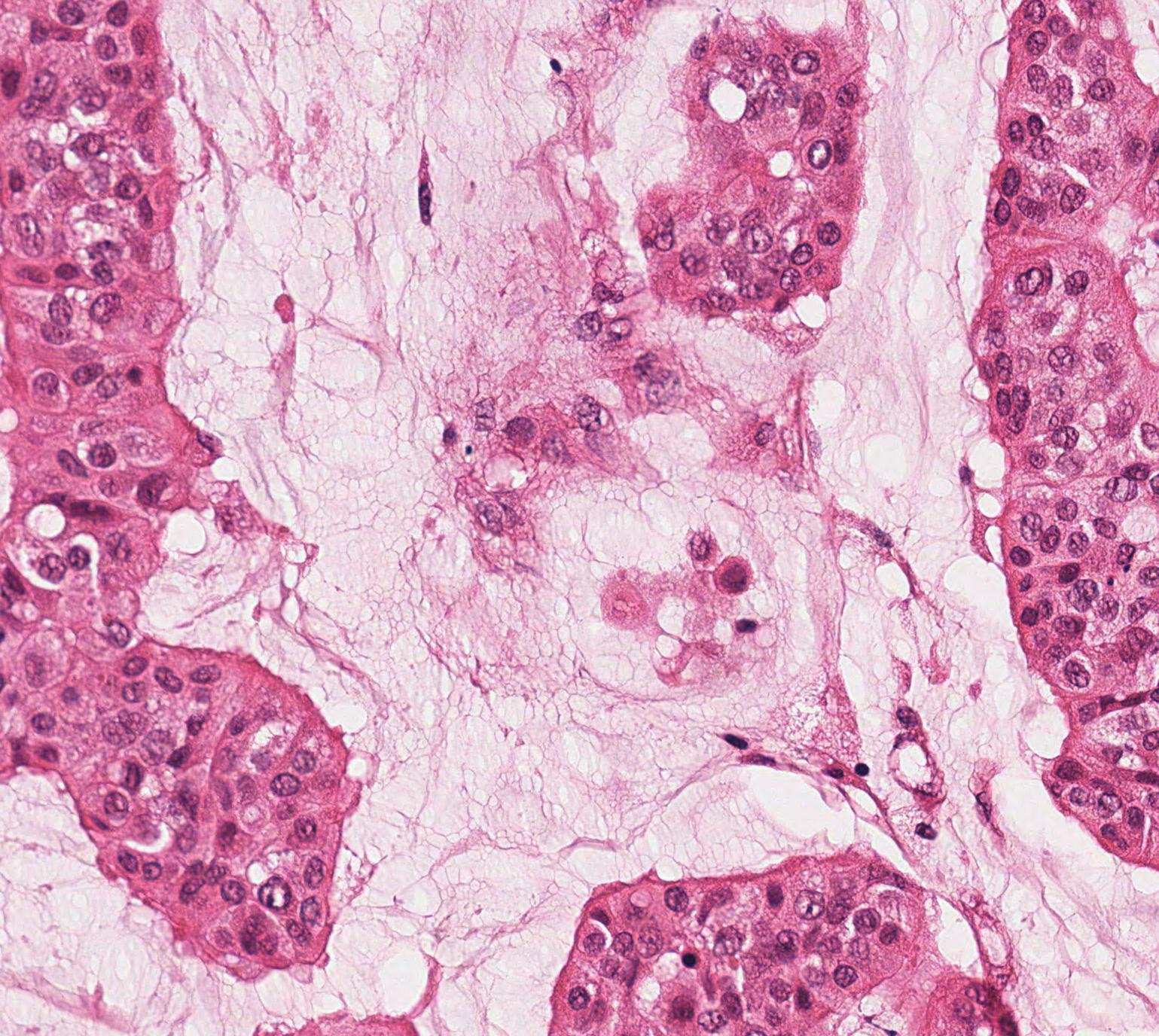 Ms Mitosis Detection2 Object Detection Dataset By Mitosisdetection