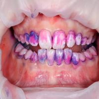 Artem (artem-xroea) - Roboflow Universe