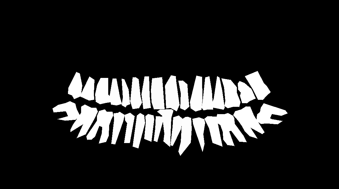 Dental x-ray kvipularya Instance Segmentation Model by abc