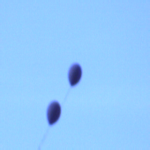 ballon_detection Object Detection Dataset and Pre-Trained Model by ...