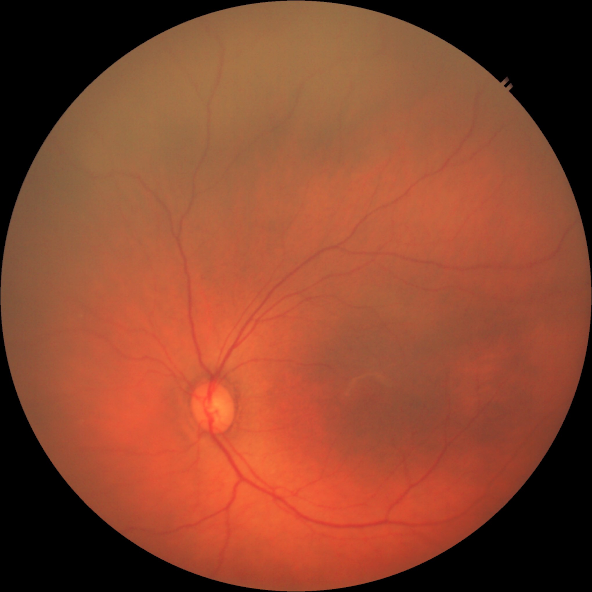 ROP Bounding Boxes Object Detection Dataset by AIROP