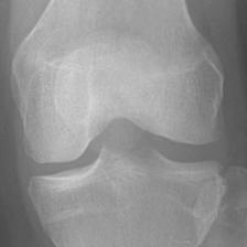 imageprocessing (imageprocessing-qvbho) - Roboflow Universe