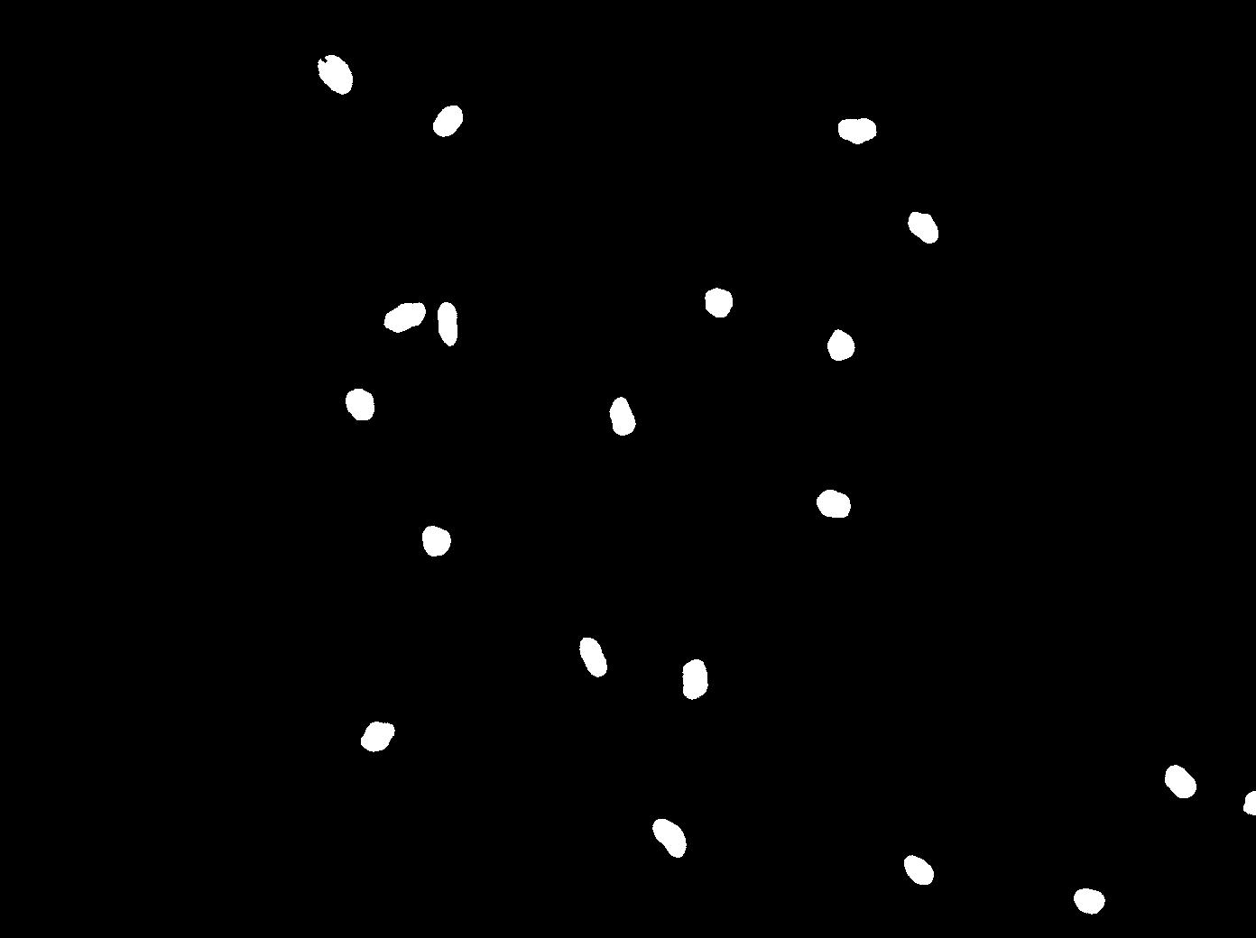Yolov5 Nuclei Detection Instance Segmentation Dataset By Diploma