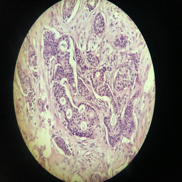 Bc Paligemma Object Detection Dataset By Anusha Shetty