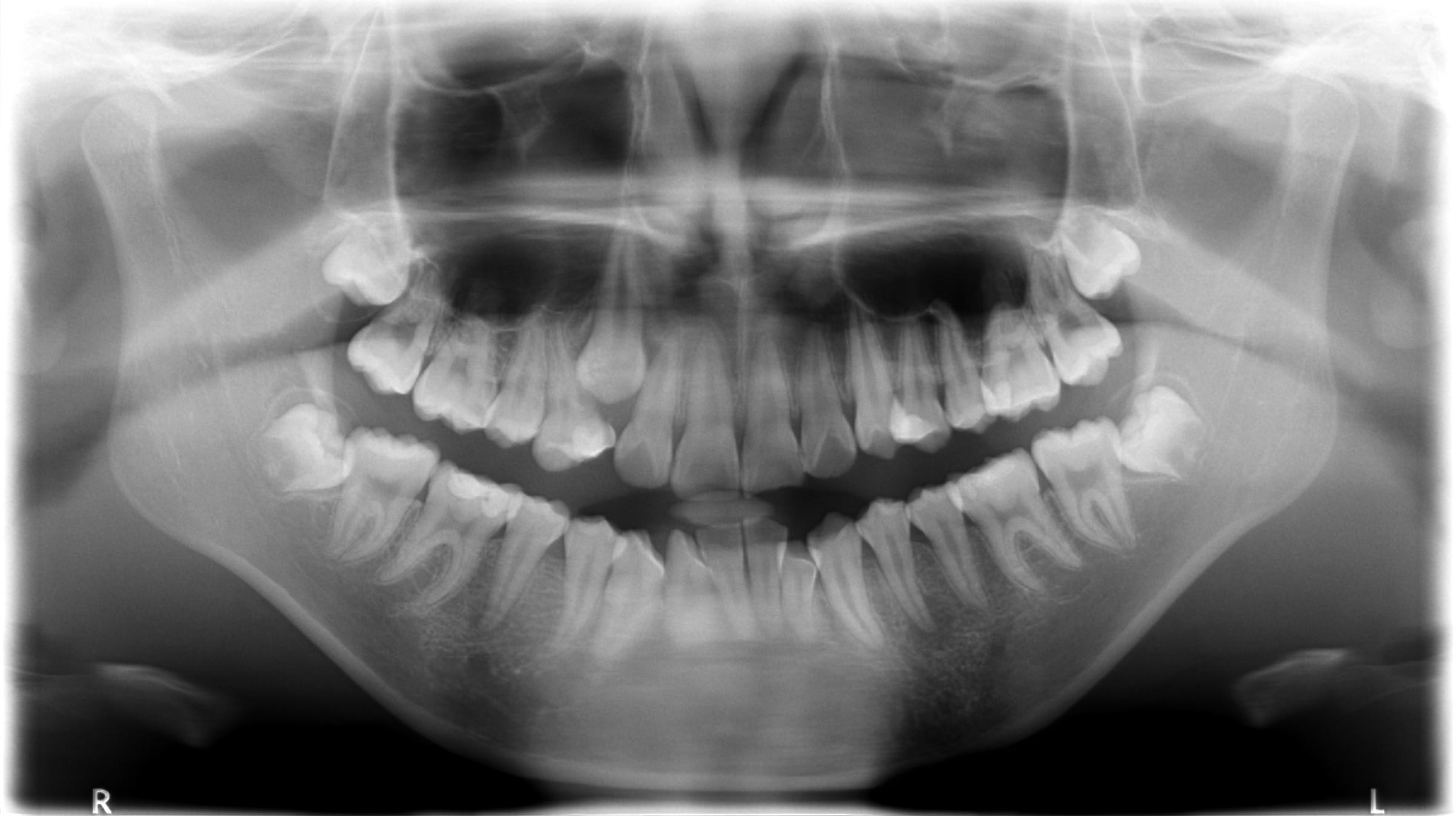 new-workspace-pkfcc - Roboflow Universe