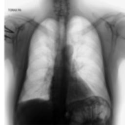 Finetuning Lungs Segmentation Instance Segmentation Model by Lungs Segmentation
