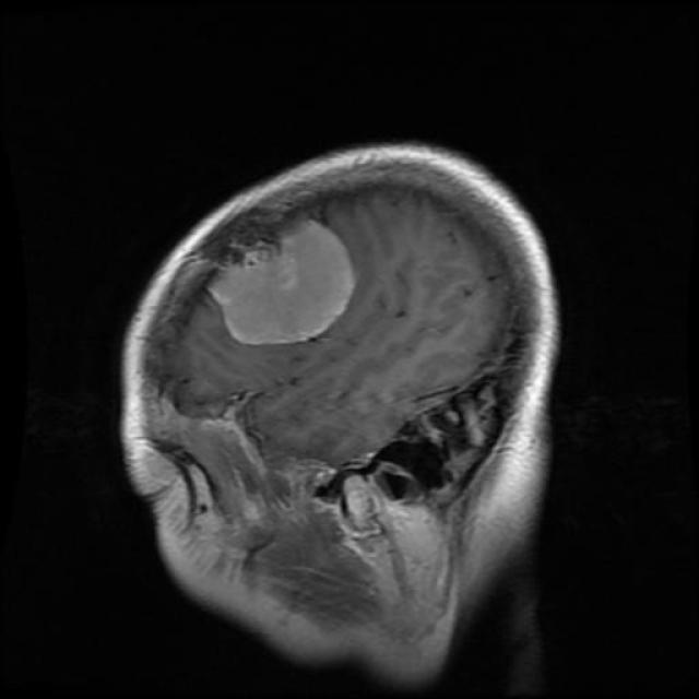 5B_SEGMENTATION Instance Segmentation Dataset by object detection