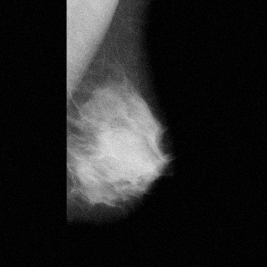 coco to voc Object Detection Dataset by yolov5reformatting