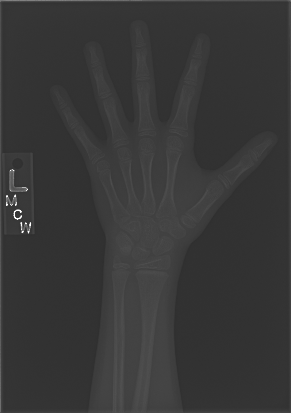 HAND_KEYPOINTS_DETETAIONS 2 Object Detection Dataset (v2, 2024-11-16 3 ...