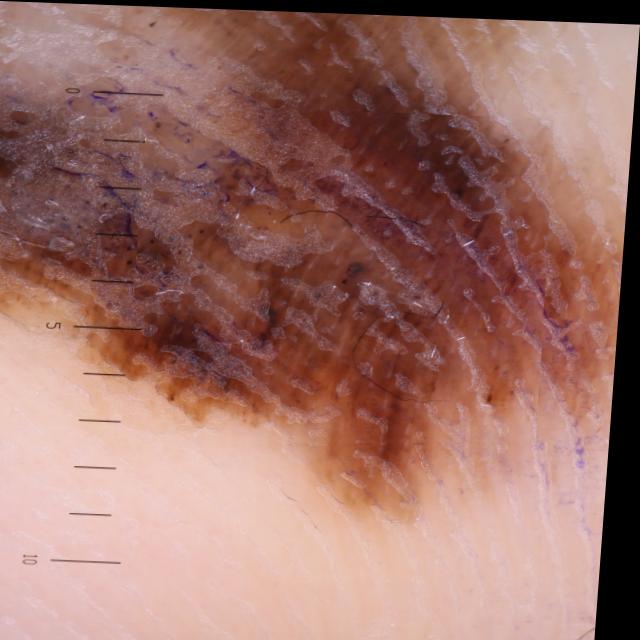 cancer Object Detection Dataset by 1