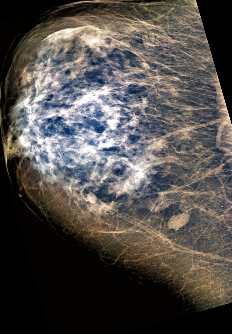 rfdetr base checkpoint - Roboflow Universe