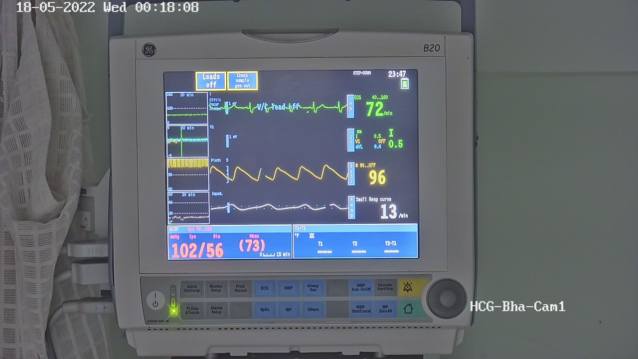 How to Use the screen Instance Segmentation API