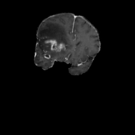 brain yolo转coco Object Detection Dataset by brain tumor brain yolo转coco Object Detection Dataset by brain tumor