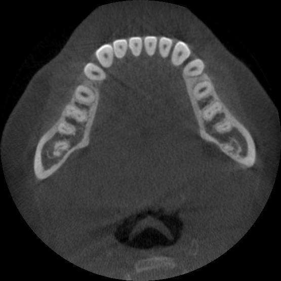 mmc_merge Object Detection Dataset by MMC Detector