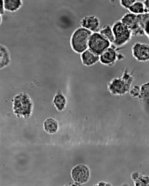 Semantic Segmentation THP-1 Macrophage Cells Semantic Segmentation ...