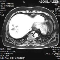 liver tumor detection Object Detection Dataset by LIVER TUMOR DATASET