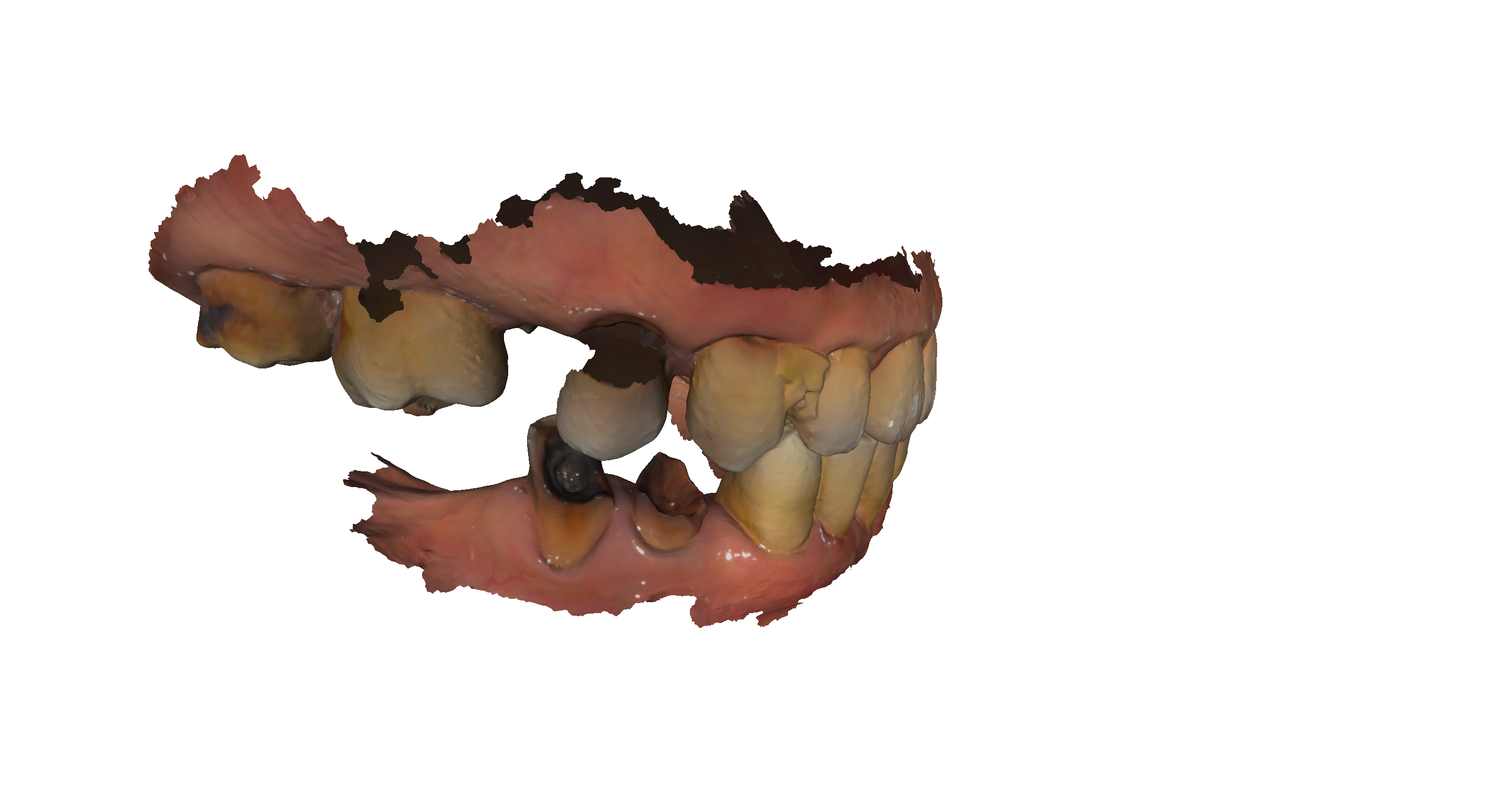tooth Object Detection Dataset by wuchengyu