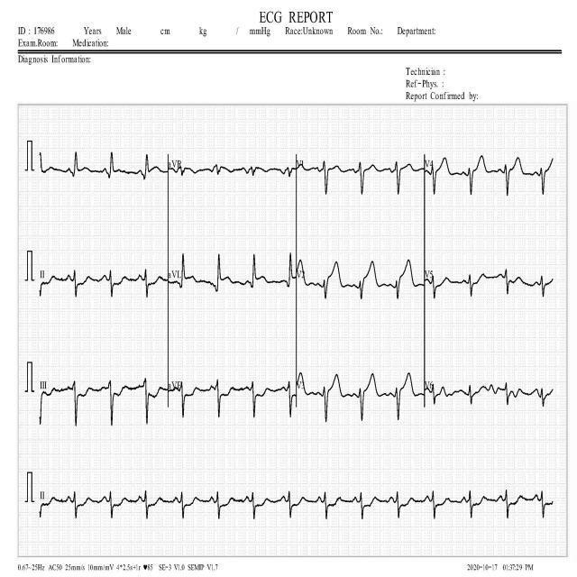 All Valid Object Detection Dataset by Individual Project