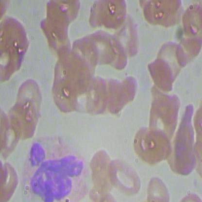 blood cell detection Instance Segmentation Model by Luvleen btp