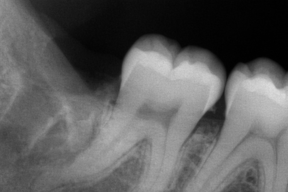 Swc Data 01 Instance Segmentation Dataset By Lums