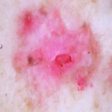 Skin-Disease-Single-Balanced Classification Dataset by LUMS