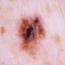 Skin-Disease-Latest Classification Dataset by LUMS