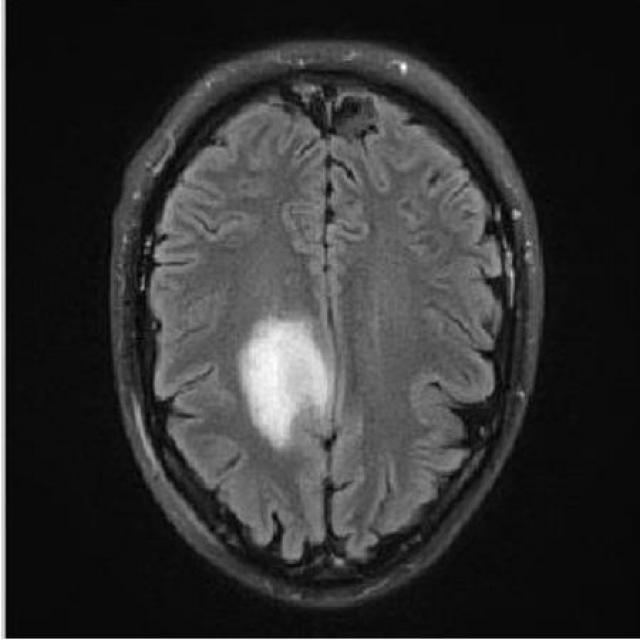 Imalin Nijitha (imalin-nijitha-3m31a) - Roboflow Universe