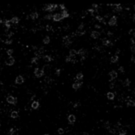 Segmentation (segmentation-tyotm) - Roboflow Universe