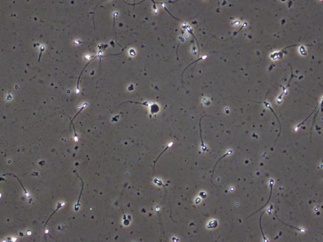 Sperm Object Detection Dataset by ID2