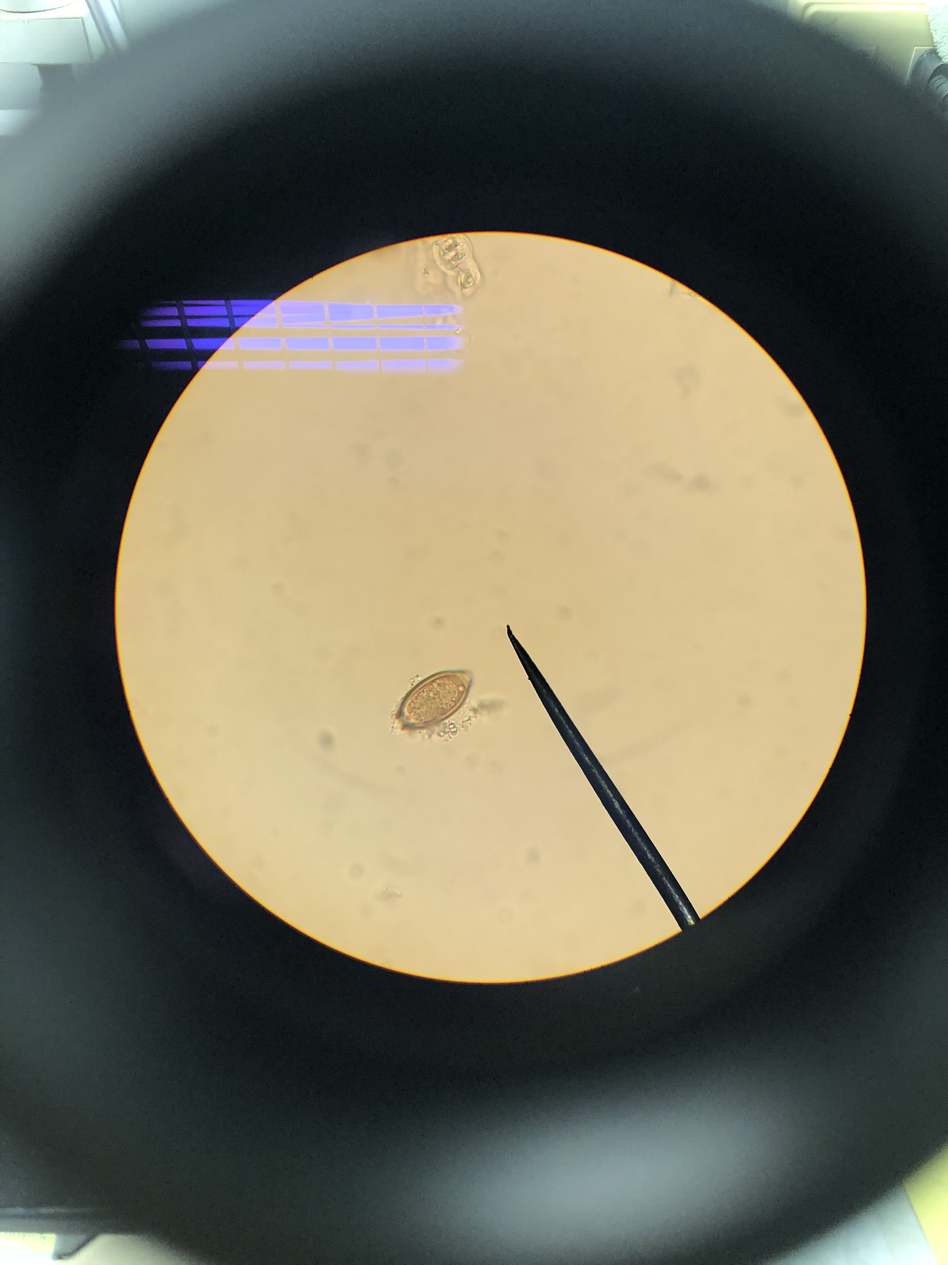 Trichuris Object Detection Dataset by new-workspace-uxfwf