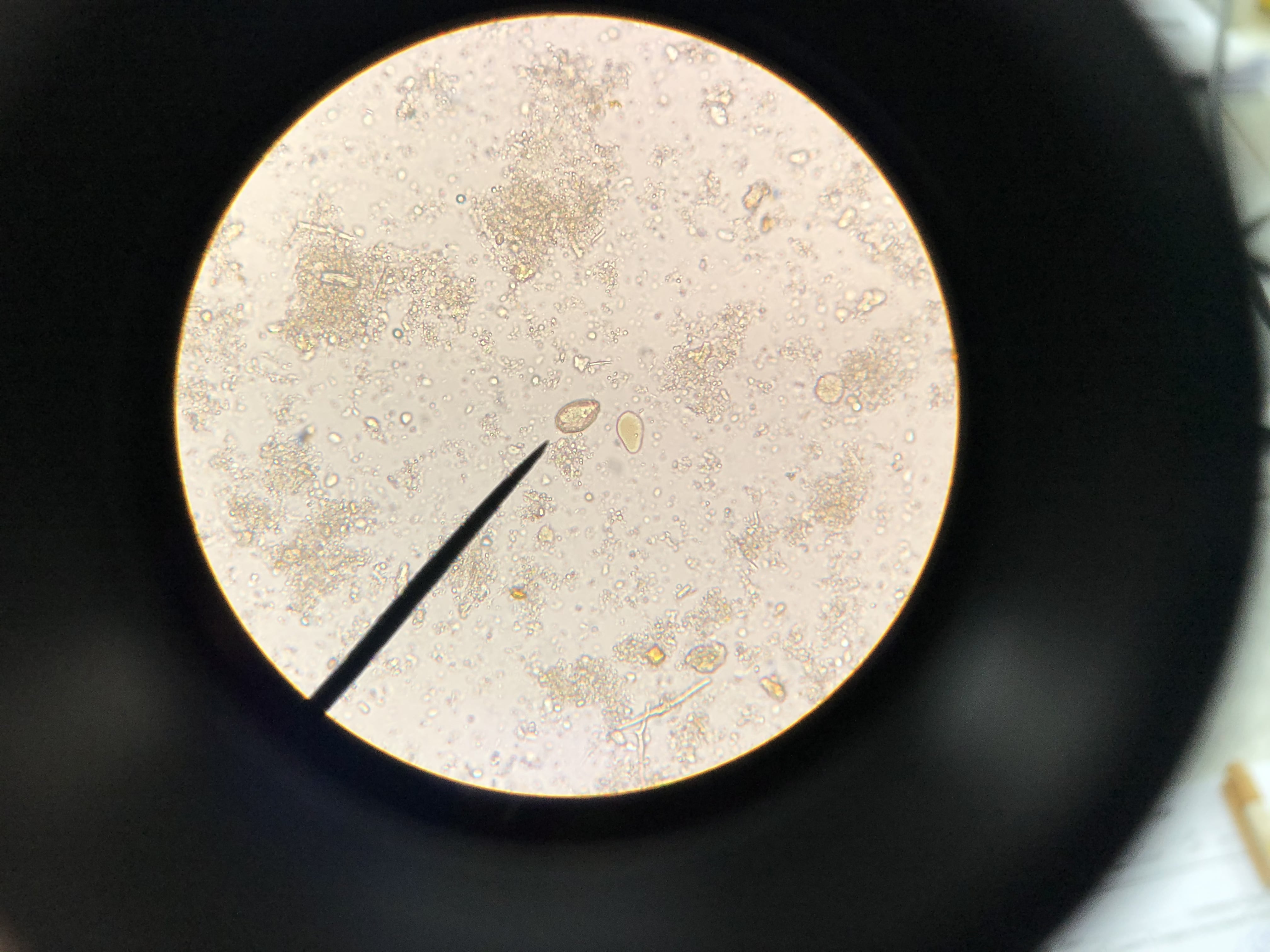 OV Object Detection Dataset by new-workspace-uxfwf