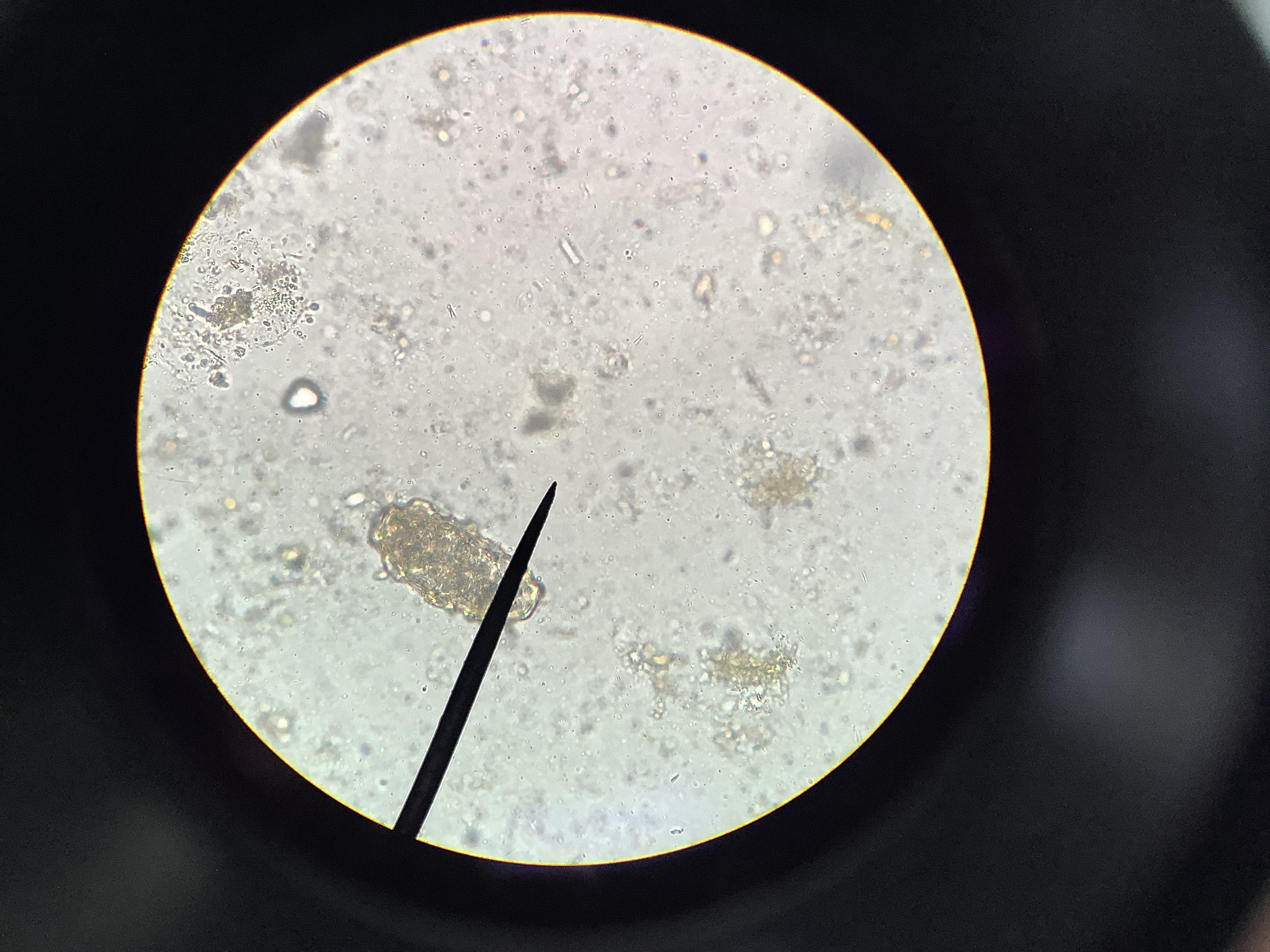 Trainparasite Object Detection Dataset by new-workspace-uxfwf