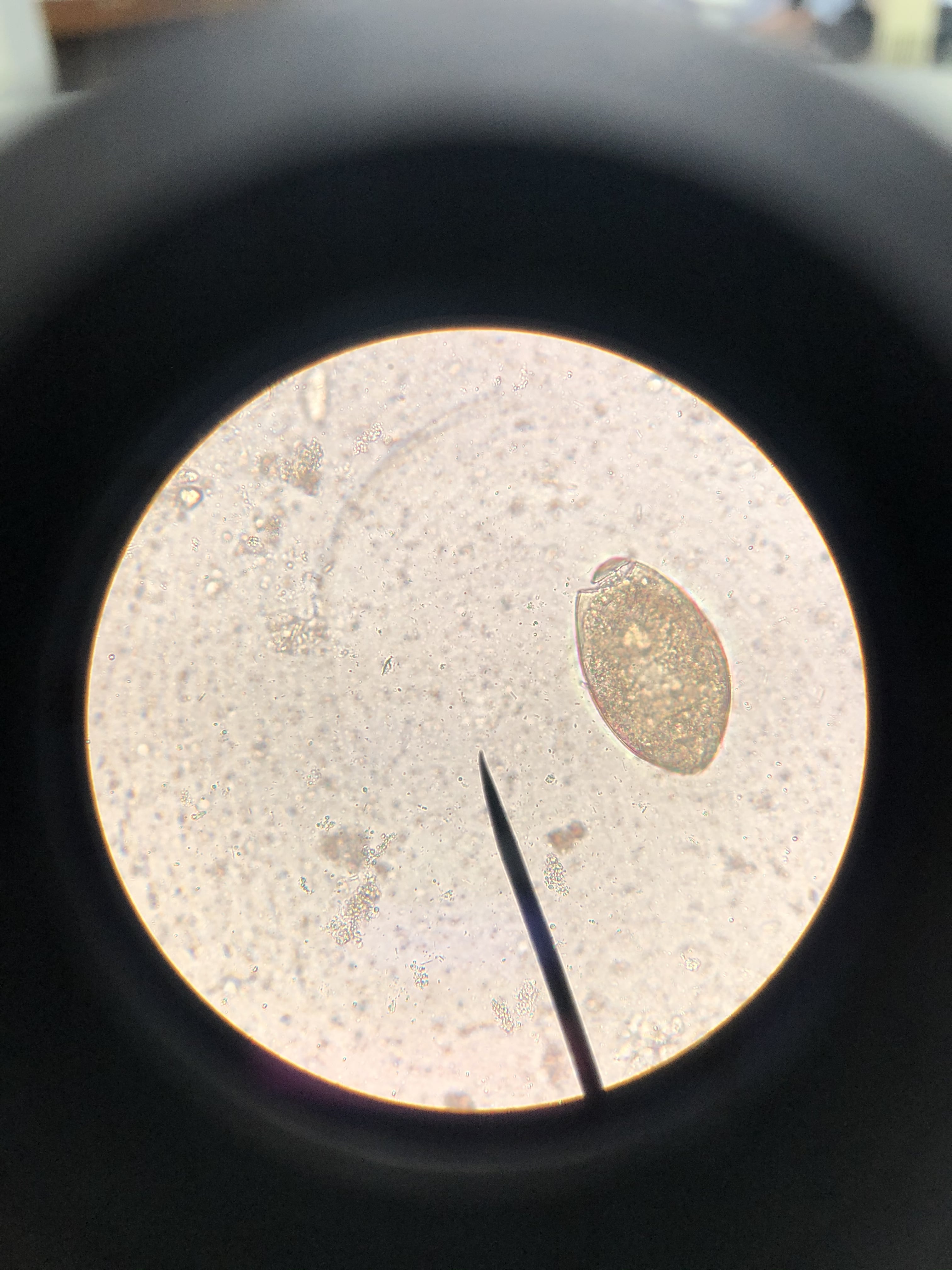 Train Object Detection Dataset by new-workspace-uxfwf