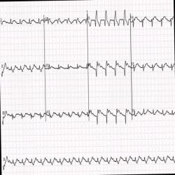 three class Classification Model by deep learning