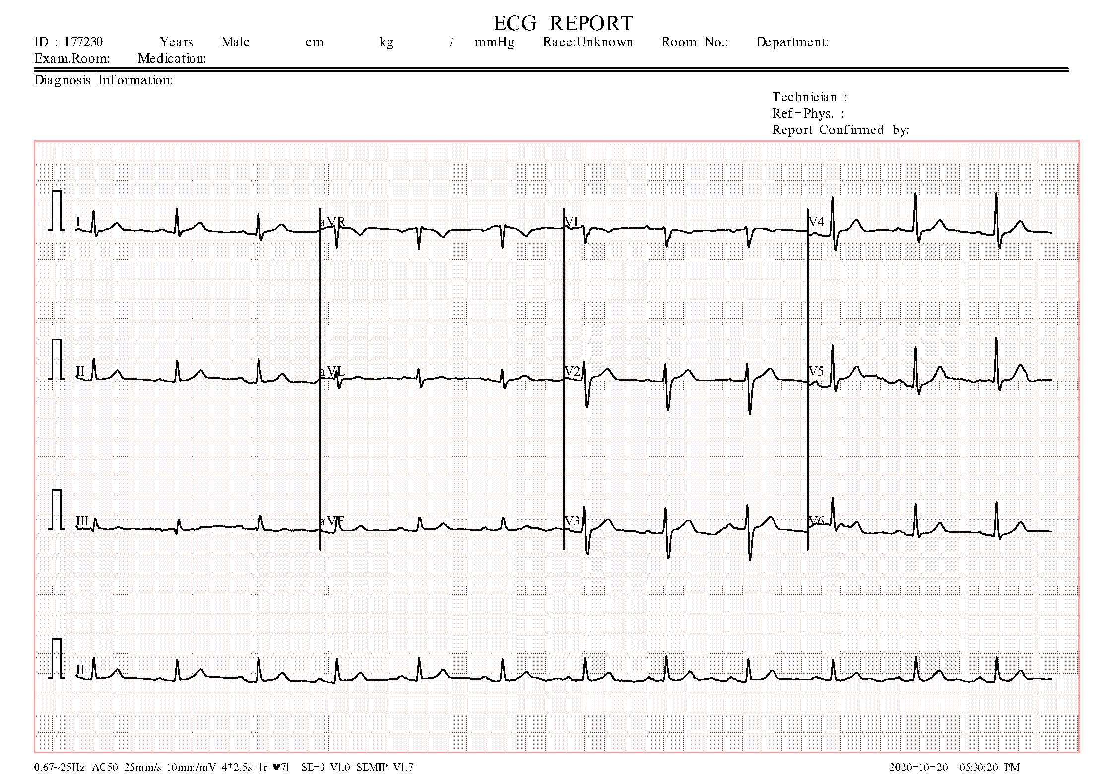 ecg Classification Dataset by deep learning