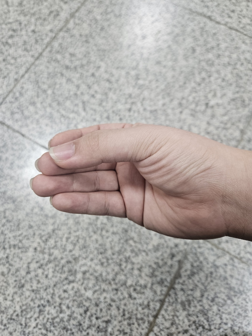 Finger Joint Detection 2 Object Detection Dataset And Pre Trained Model By Sunchul