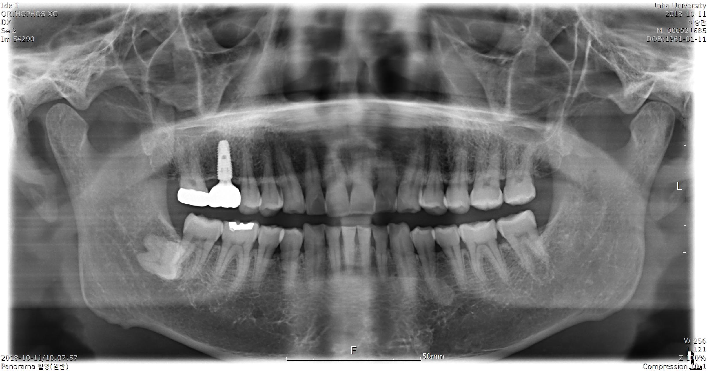 Perio label - Roboflow Universe