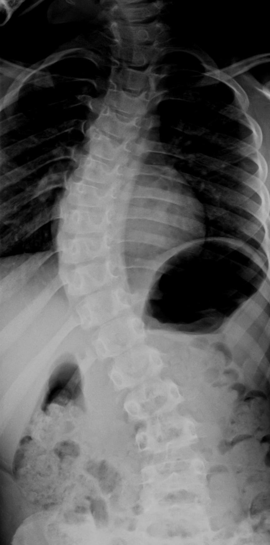 BONE Object Detection Dataset and Pre-Trained Model by izzyy