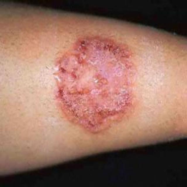 ditm - Roboflow Universe