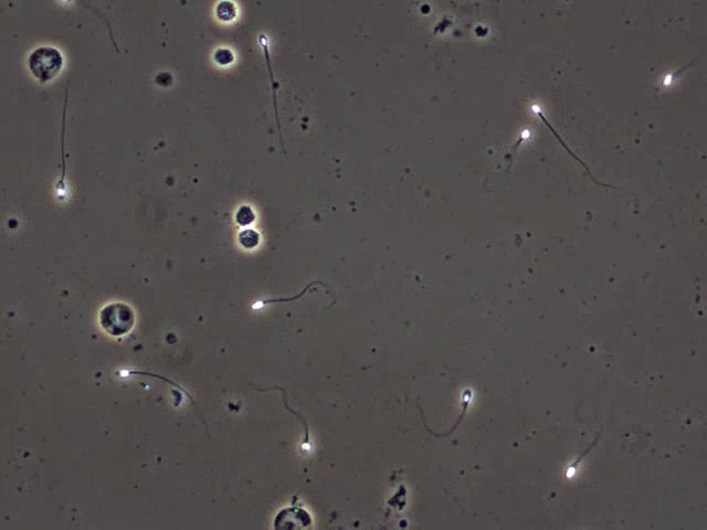 Sperm Detection 2 Object Detection Model by p